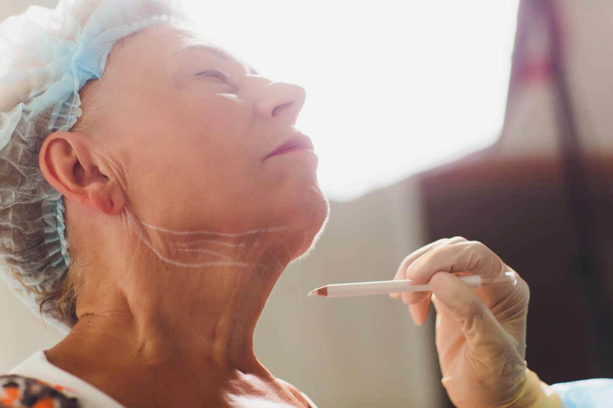 How a Thread Lift Procedure Can Improve Your Facial Appearance - Fat 2 Code